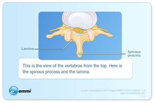 Lumbar Decompression Surgery