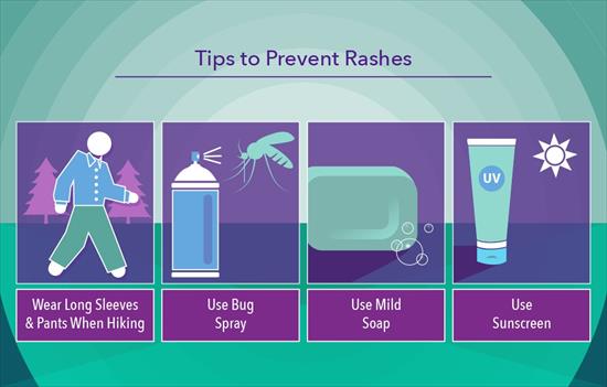 What You Need to Know About Rashes