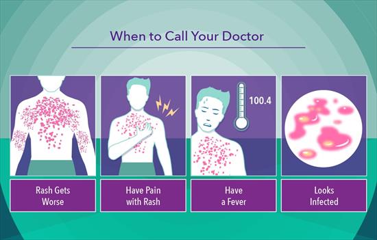 What You Need to Know About Rashes