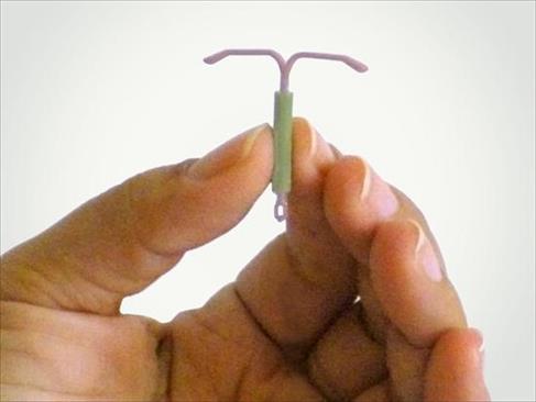 Birth Control Iud