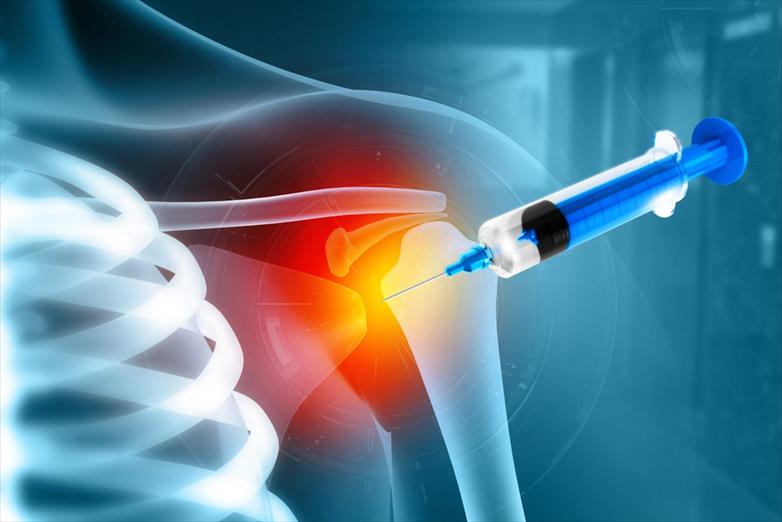 What to Know about Joint Injections for Arthritis