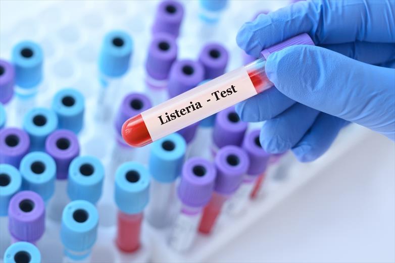 6 Things to Know About Listeria