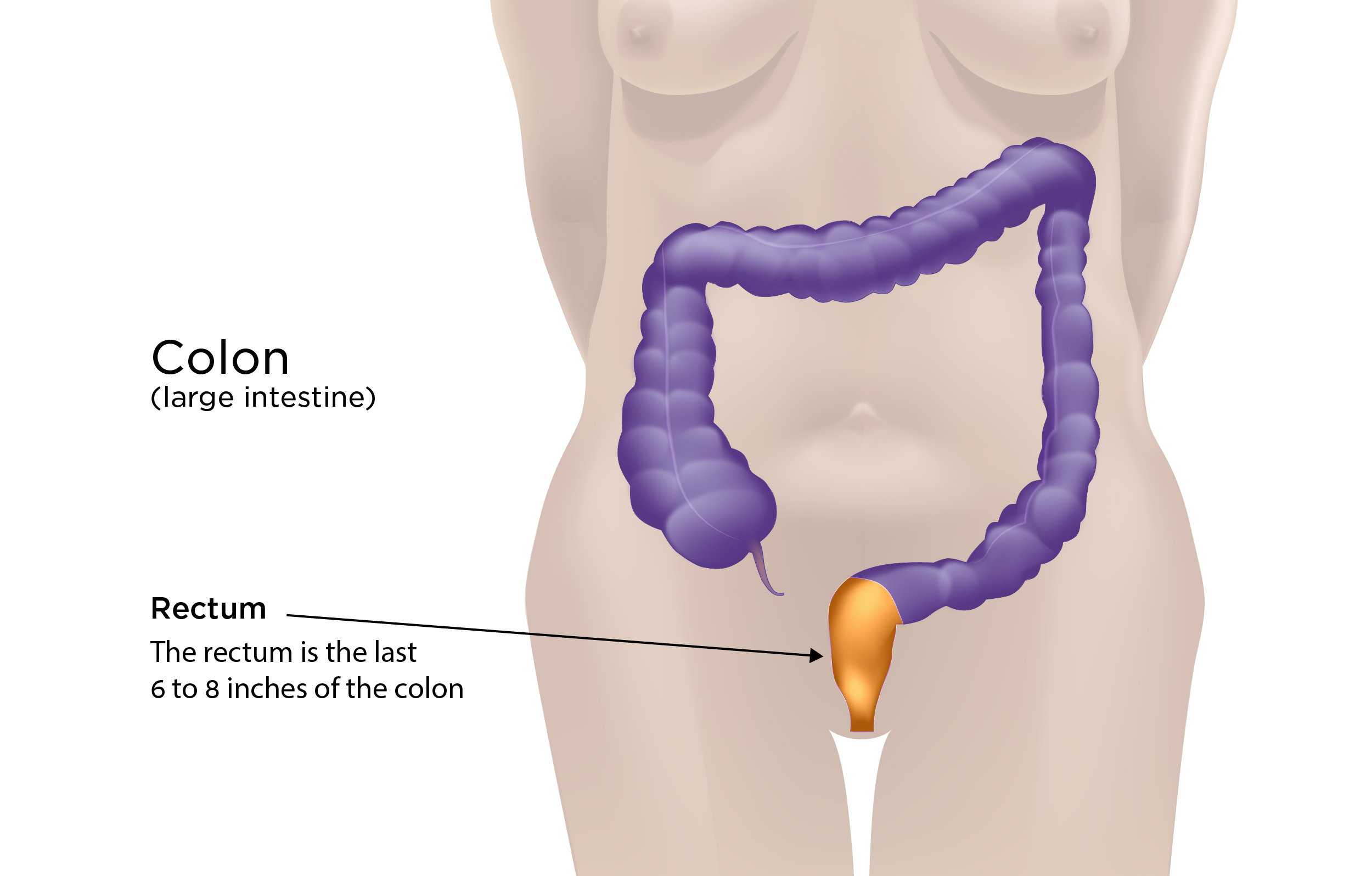 Ulcerative Proctitis