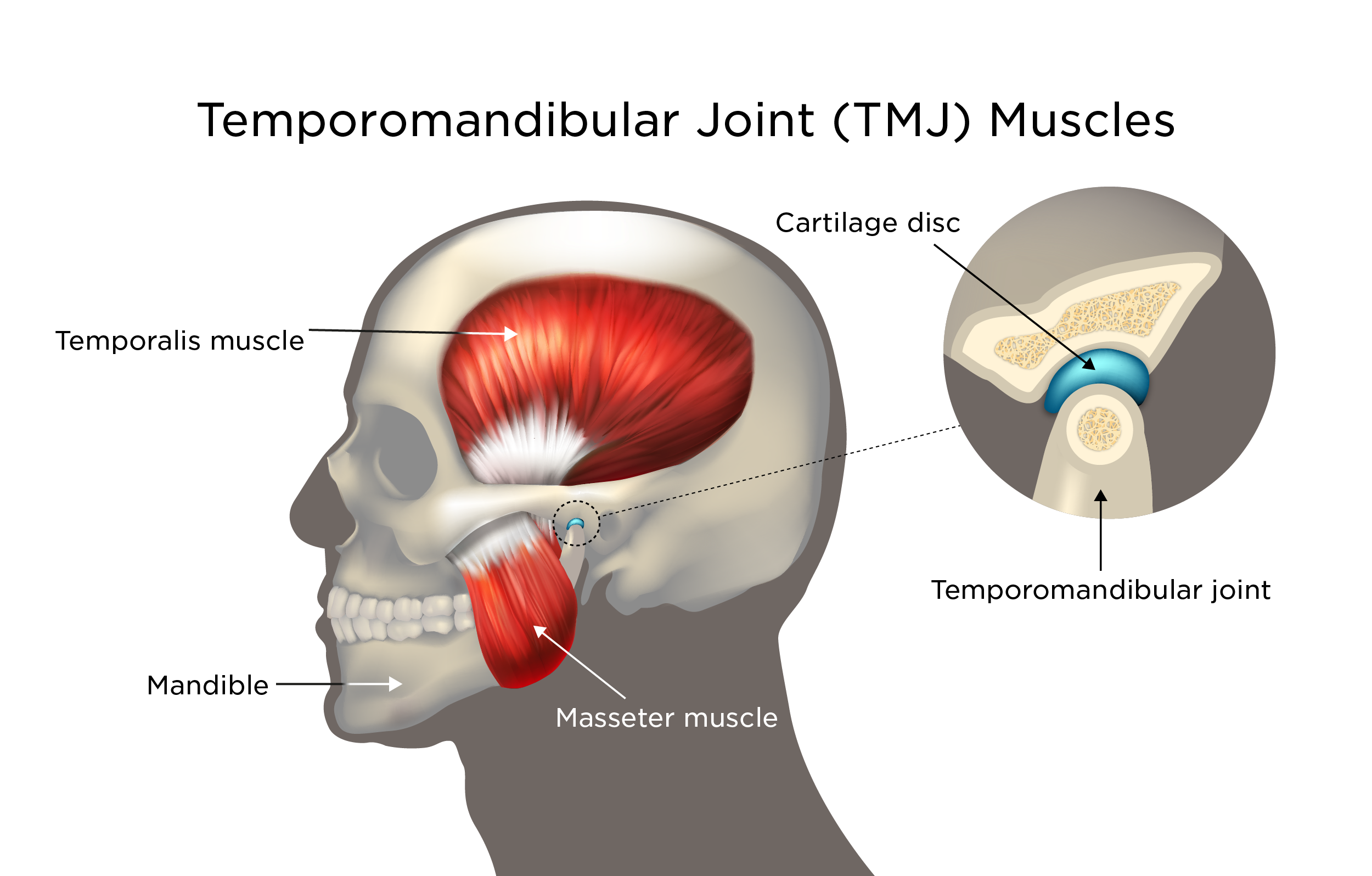 Temporomandibular Joint Disorder (TMJD) | My Doctor Online