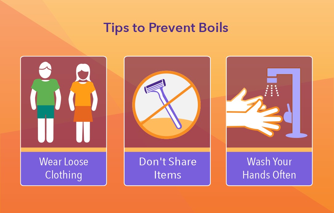 What to Do About Boils | My Doctor Online