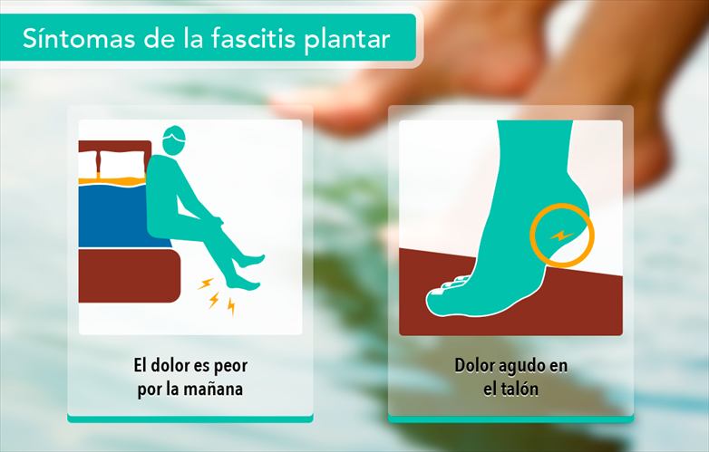 Consejos para tratar el dolor de talón | My Doctor Online