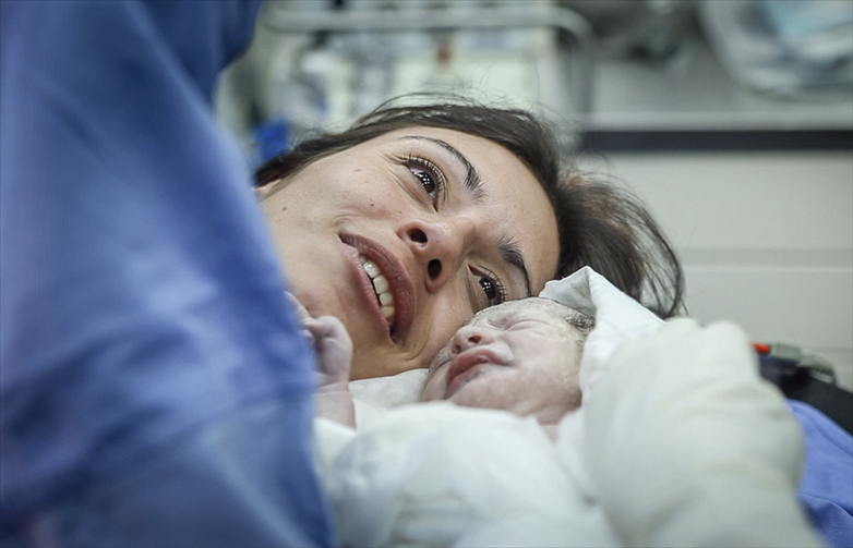 Cesarean Birth (C-Section) | My Doctor Online